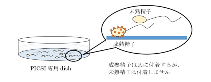PICSI (Physiologic intracytoplasmic sperm injection)について(2023年3月)｜英 ...